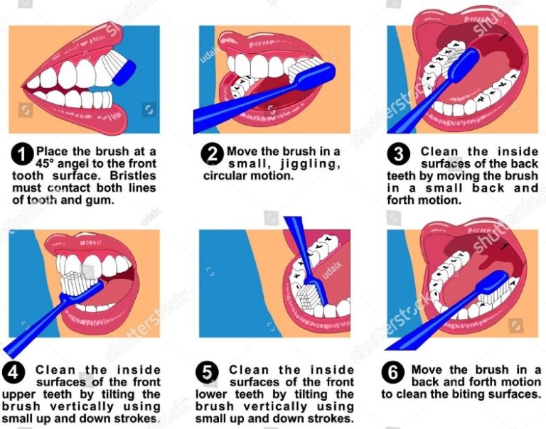 How To Manage Your Oral Health at Home